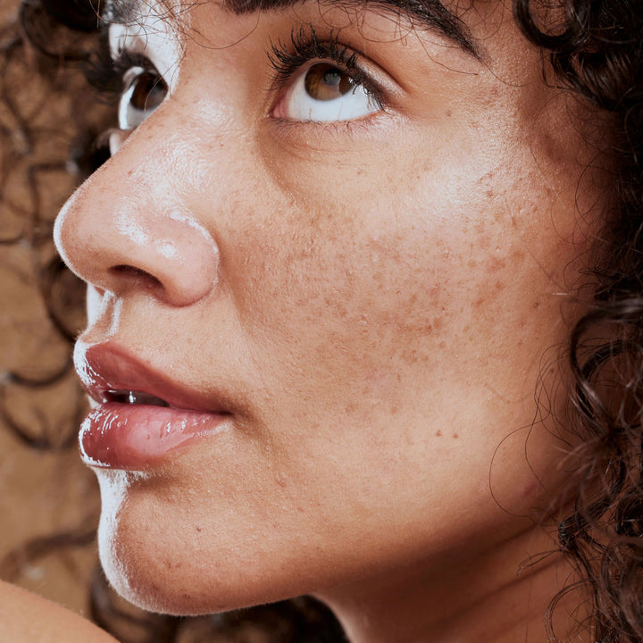 Cómo identificar y cuidar la piel mixta correctamente – BlauVerde